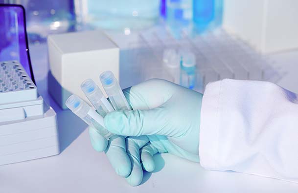 About Us - Host Cell Protein Analysis - Creative Diagnostics