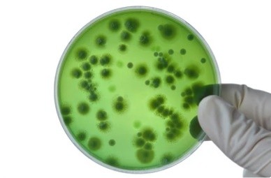 Microbial Enumeration - Creative Diagnostics