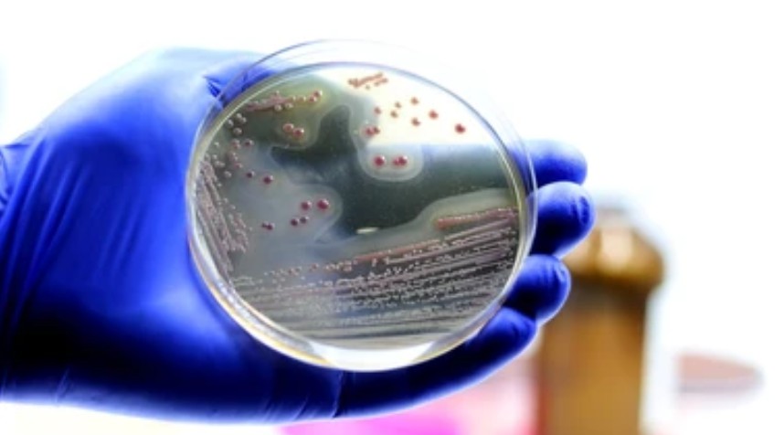 Microbial Air Monitoring - Creative Diagnostics