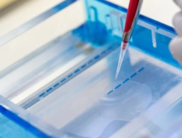 HCP Analytical Services - Creative Diagnostics