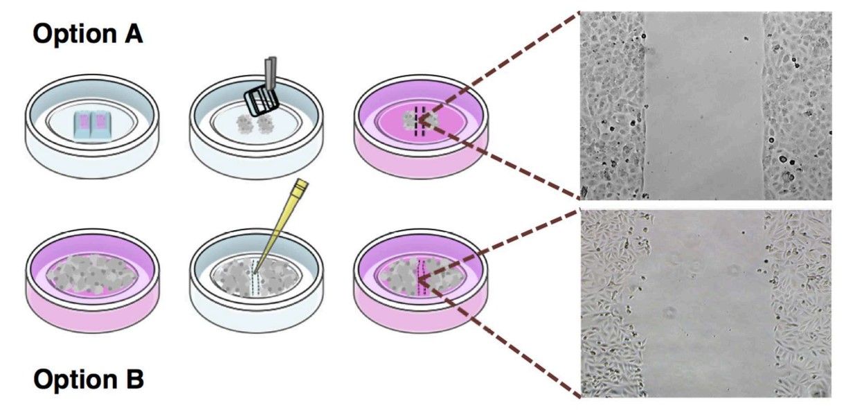 Cell Adhesion and Migration Assay - Creative Diagnostics