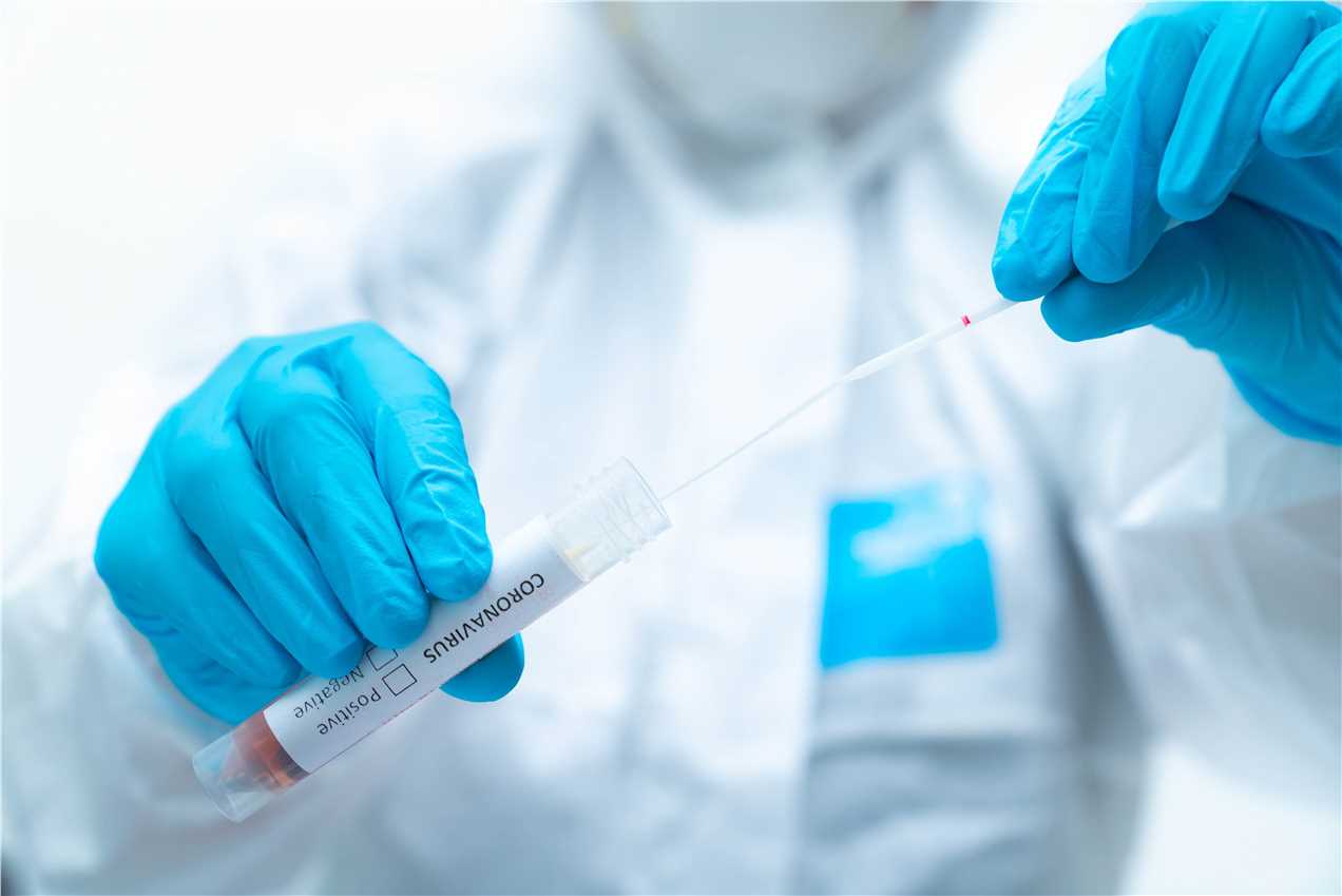 Characterization and Quality Control of mAbs - Creative Diagnostics