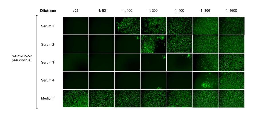 Efficient Pseudovirus-Based Drug Screening Platform - Creative Diagnostics