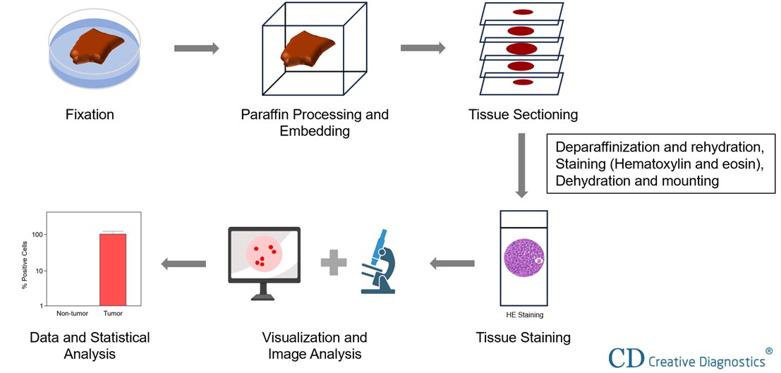 Hematoxylin-Eosin (HE) Staining - Creative Diagnostics