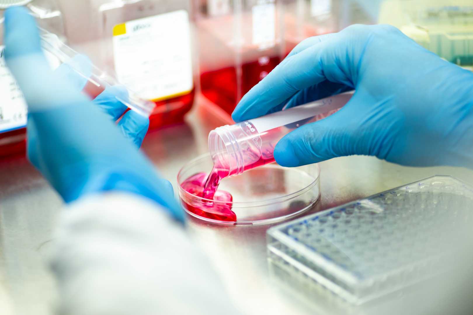 High-yielding NK Cell Expansion Kits - Creative Diagnostics