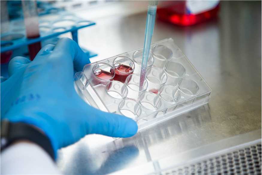 Therapeutic mAbs & Proteins - Creative Diagnostics