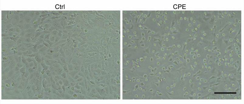 Viral Quantitation for Quality Control or Efficacy Evaluation of Biopharmaceuticals-Creative ...